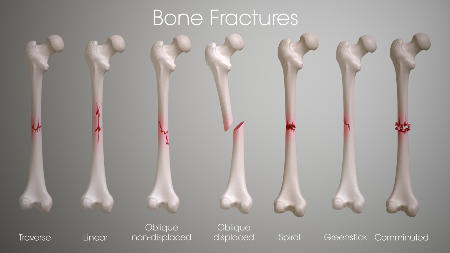 10 Common Orthopedic Injuries: Causes, Symptoms, and Treatment